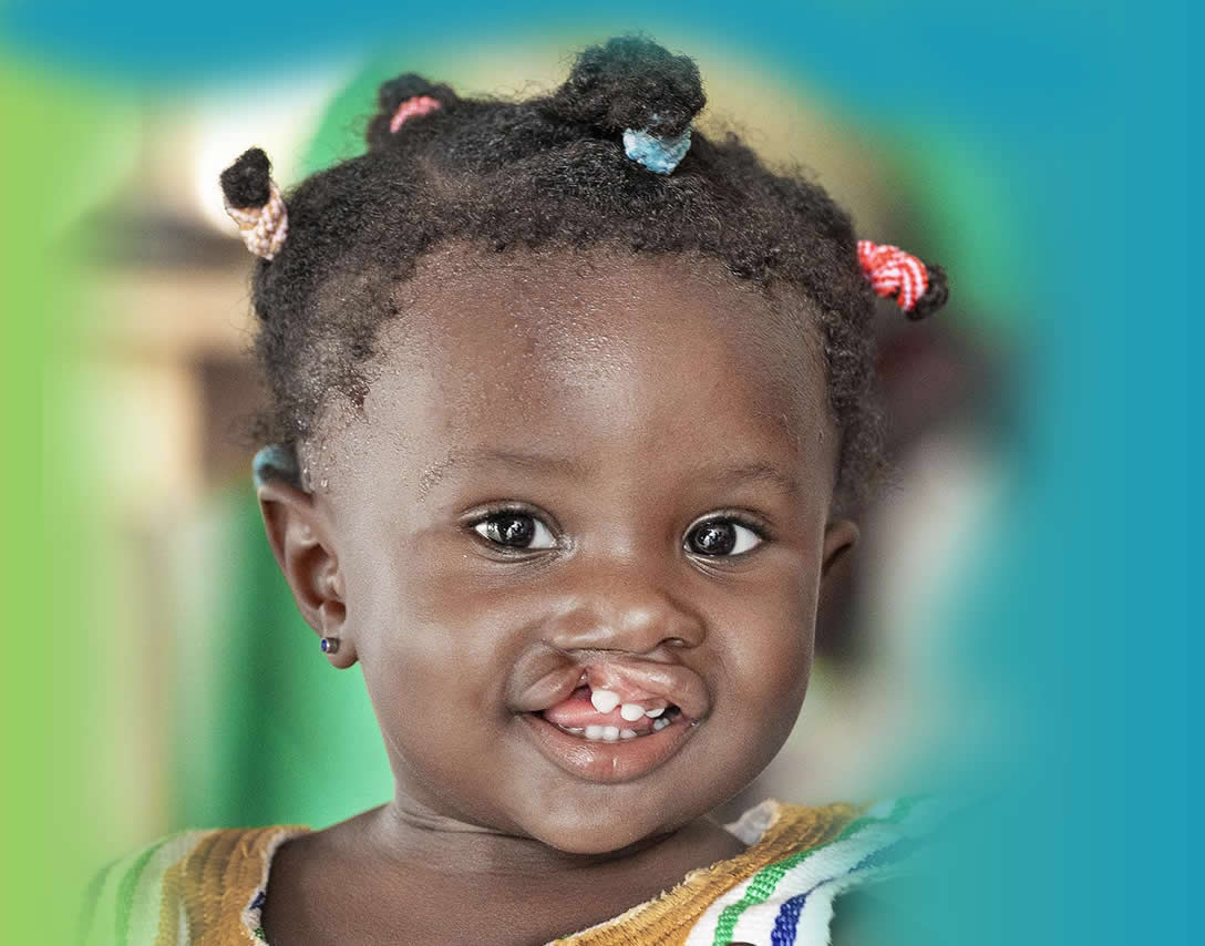 Home - Operation Smile South Africa